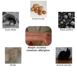 How to Get Rid of Allergens in Your Home